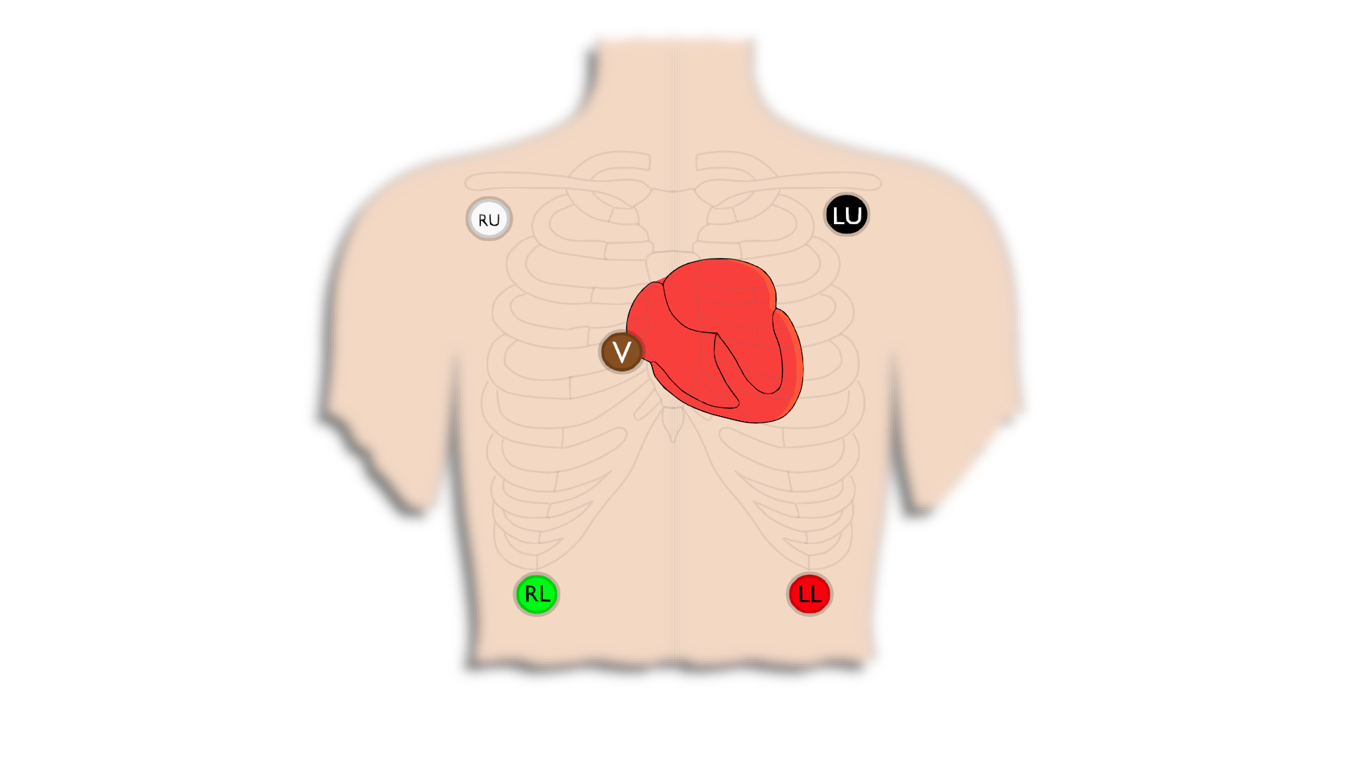 5-Lead ECG – Nursing Unraveled