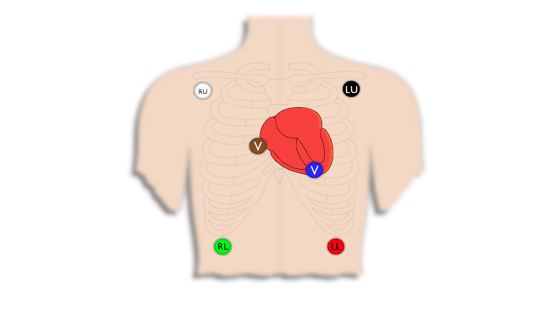 What is Electrocardiogram (ECG)? – Nursing Unraveled