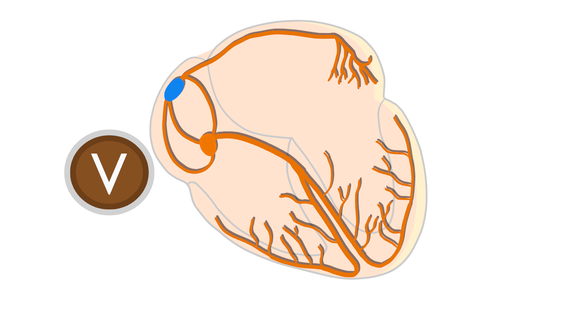 5-Lead ECG – Nursing Unraveled