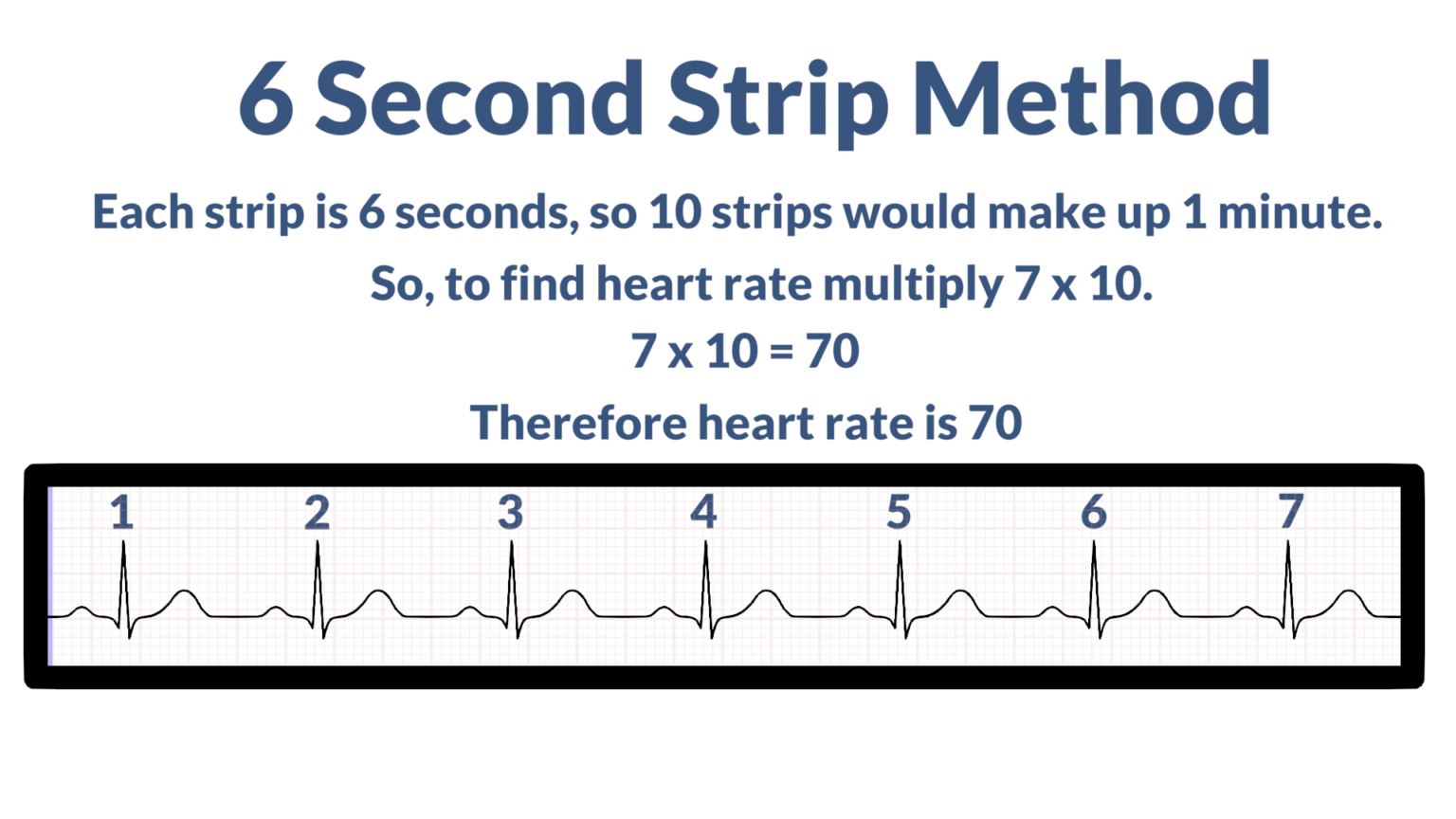 Interpreting ECG Strips – Nursing Unraveled