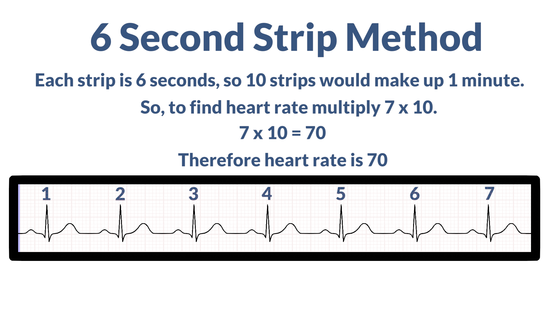 Interpreting ECG Strips Nursing Unraveled