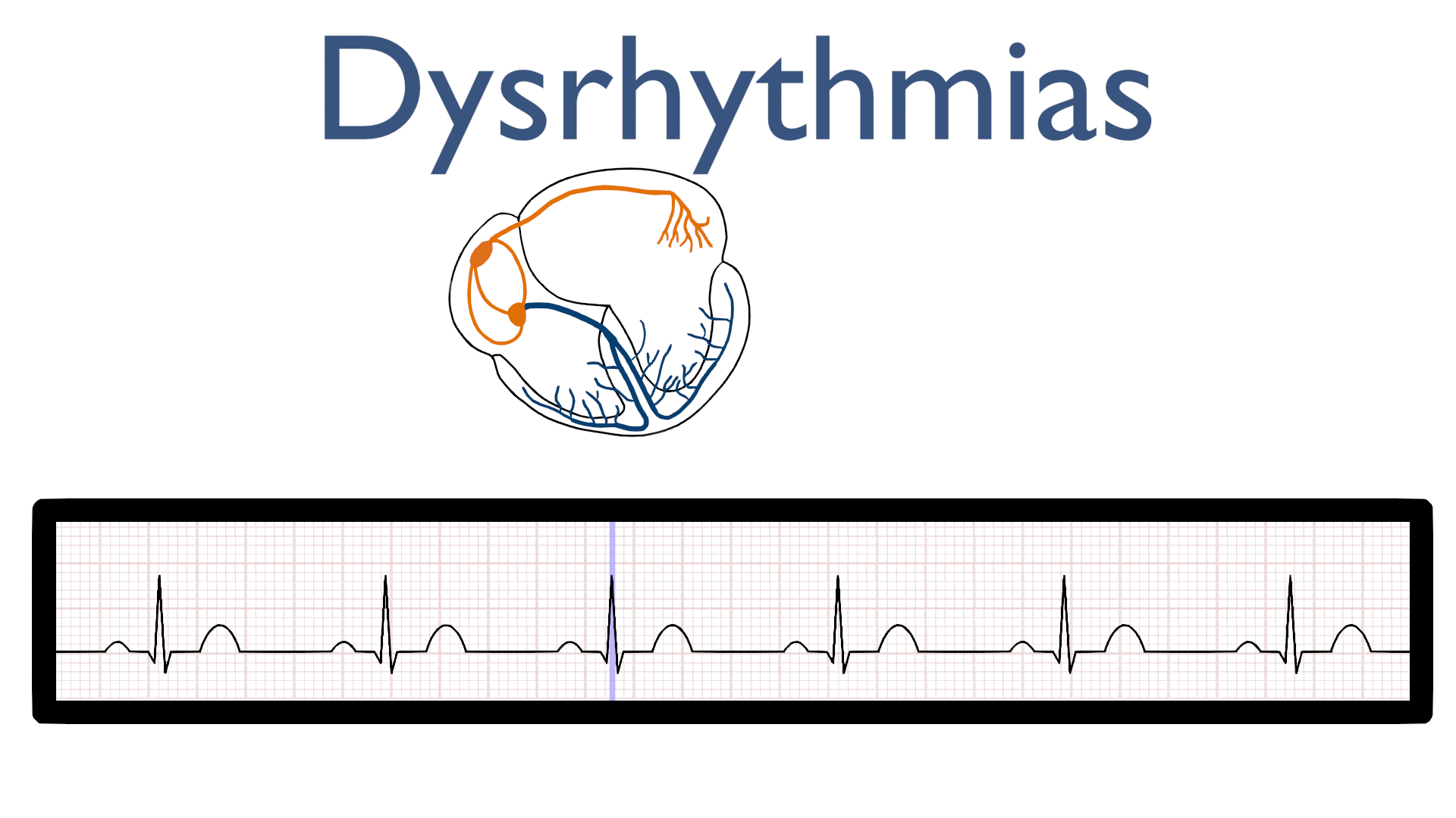 ECG Course – Nursing Unraveled