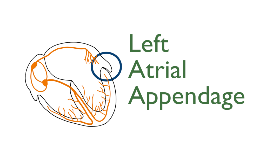 Atrial Fibrillation (AF) – Nursing Unraveled