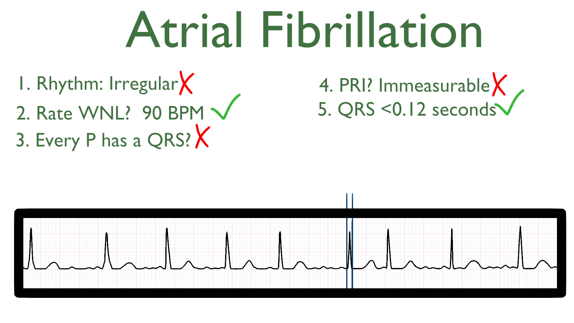 Atrial Fibrillation (AF) – Nursing Unraveled