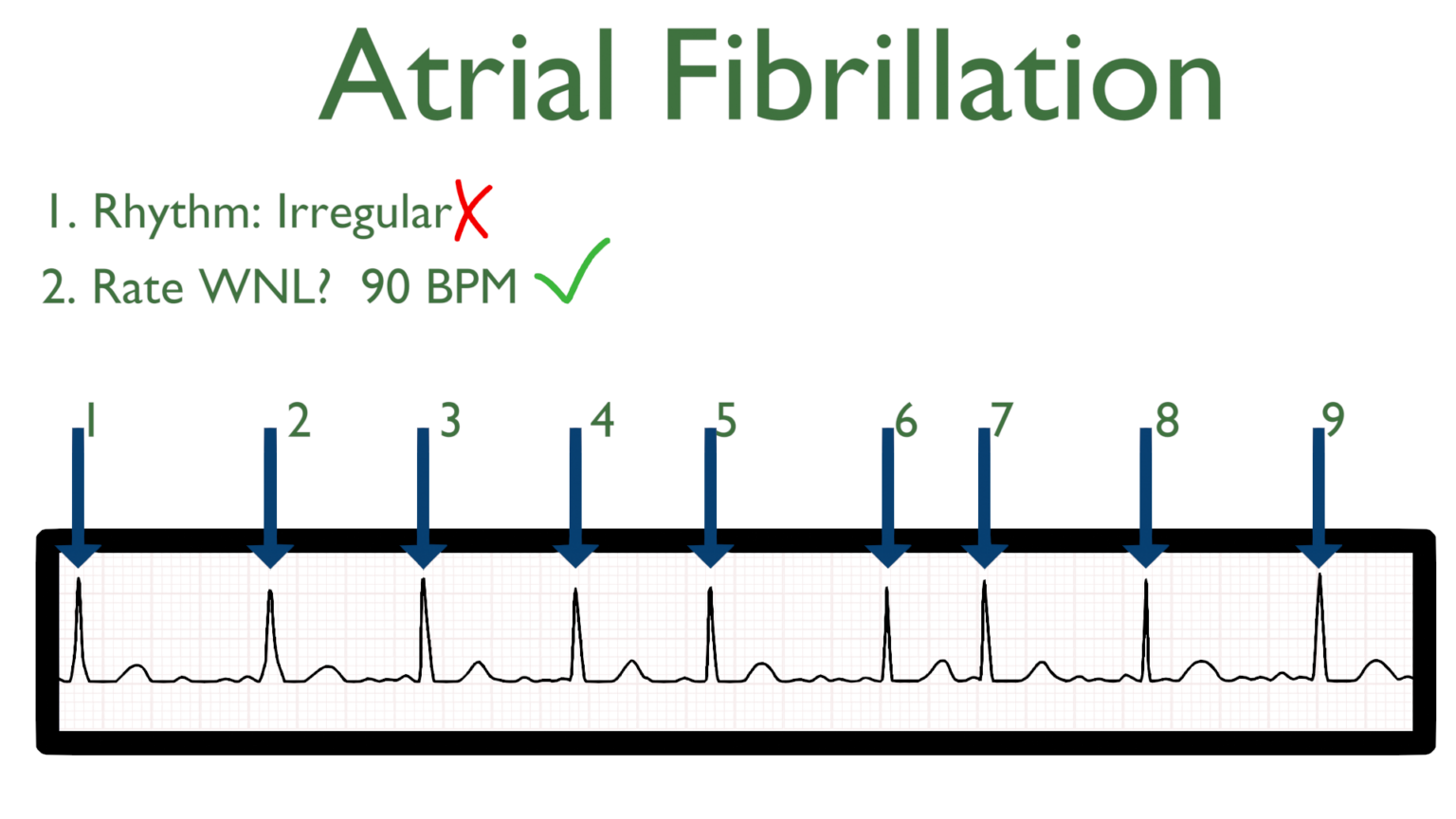 Atrial Fibrillation (AF) – Nursing Unraveled