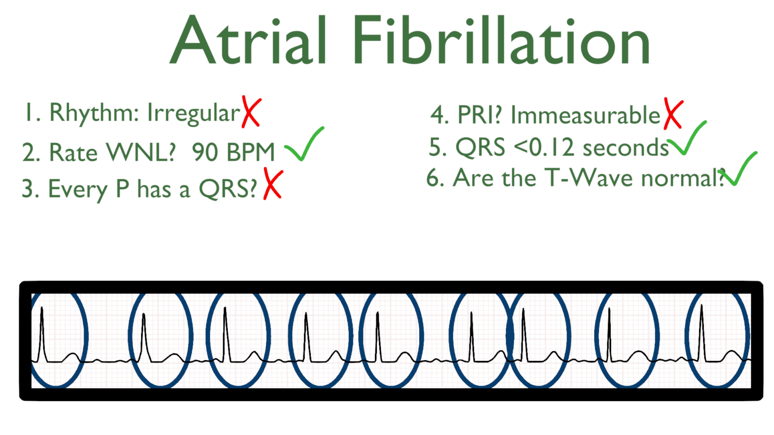 Atrial Fibrillation (AF) – Nursing Unraveled