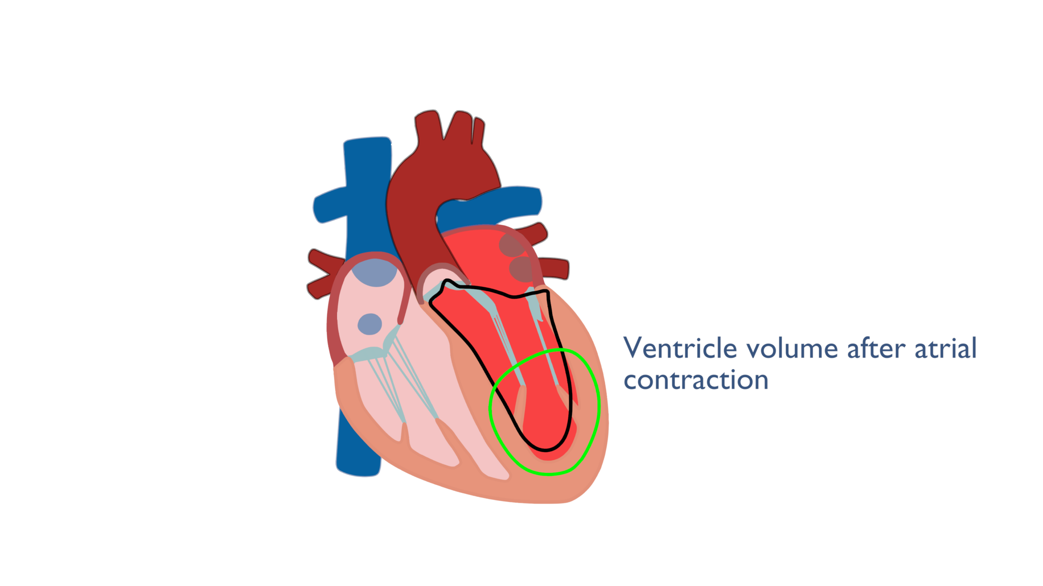 Cardiac Output – Nursing Unraveled